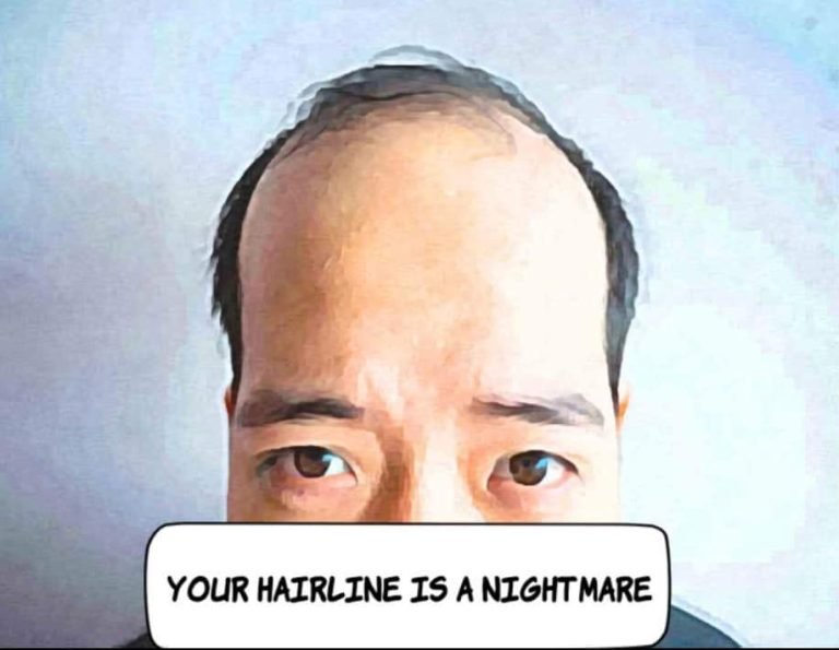20 Funny Hairline Roasts for Someone with Receding Hairline - RoastHow